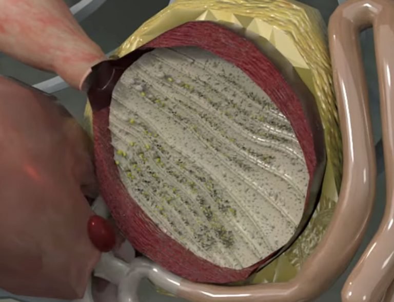 What Is A Gizzard In A Bird? Know Its Function And Disease! - The ...